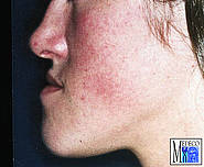 MEDECO Zahnklinik Augsburg: Mandibuläre Prognathie