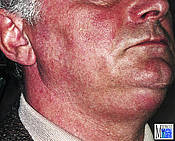 MEDECO Braunschweig - Die Zahnärzte | Zahnerhaltung | Implantate ...