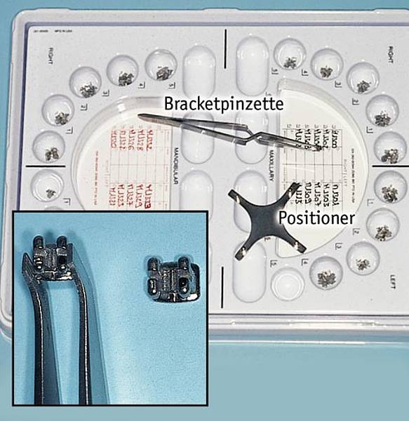 Festsitzende Apparaturen